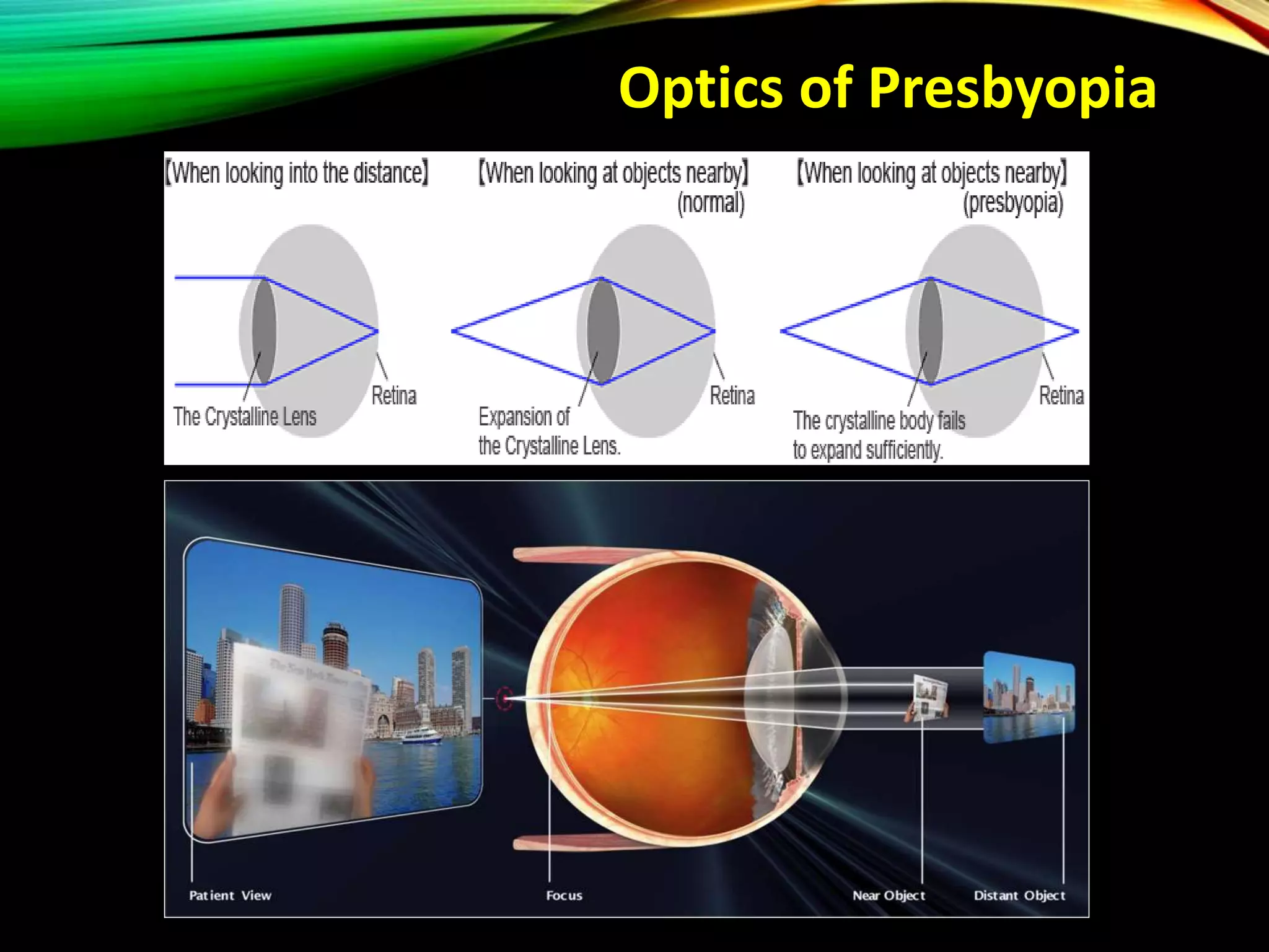 Presbyopia/ Methods of Presbyopic Addition Determination (healthkura ...