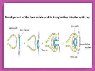 Ocular Embryology | PPTX | Eye and Vision Conditions | Diseases and ...