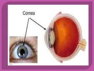 Ocular Embryology | PPTX | Eye and Vision Conditions | Diseases and ...