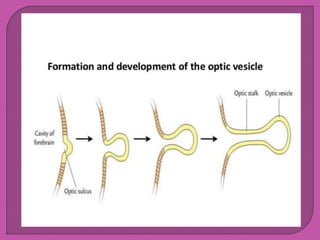 Ocular Embryology | PPTX | Eye and Vision Conditions | Diseases and ...
