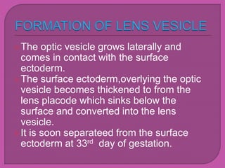 Ocular Embryology | PPTX