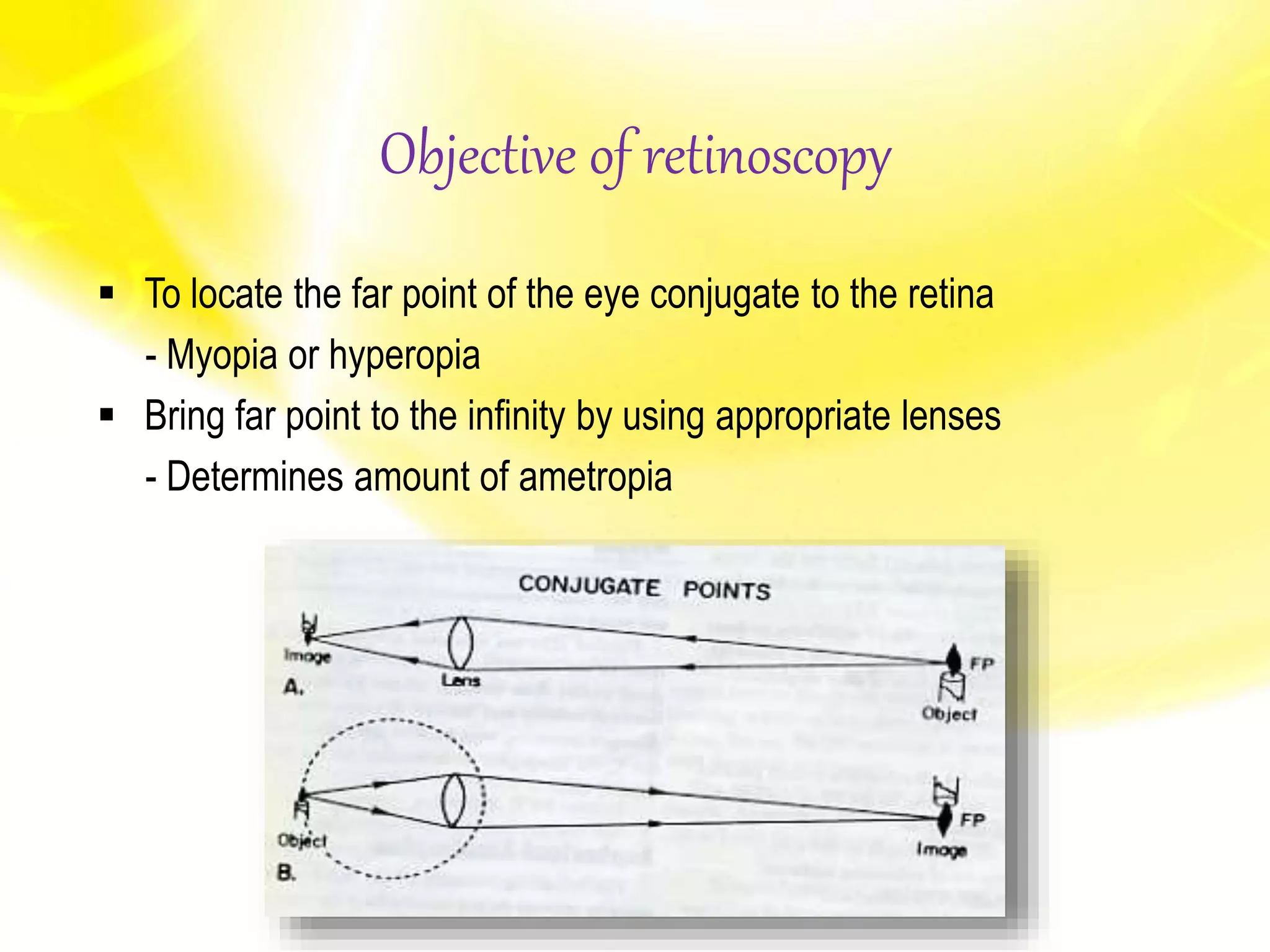 Retinoscopy/ Objective Refraction / Retinoscopy of eye (Principle ...