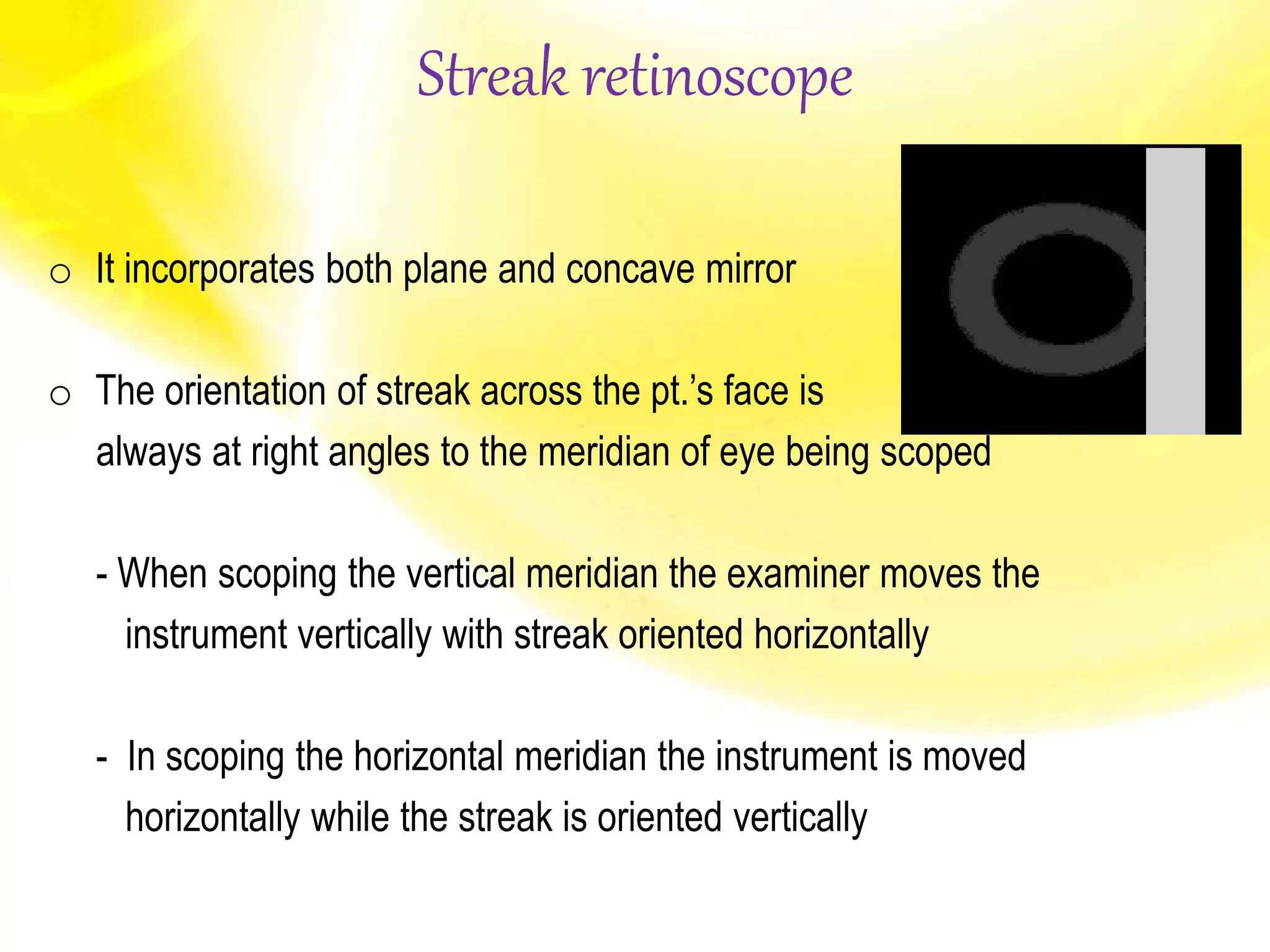 Retinoscopy/ Objective Refraction / Retinoscopy of eye (Principle ...