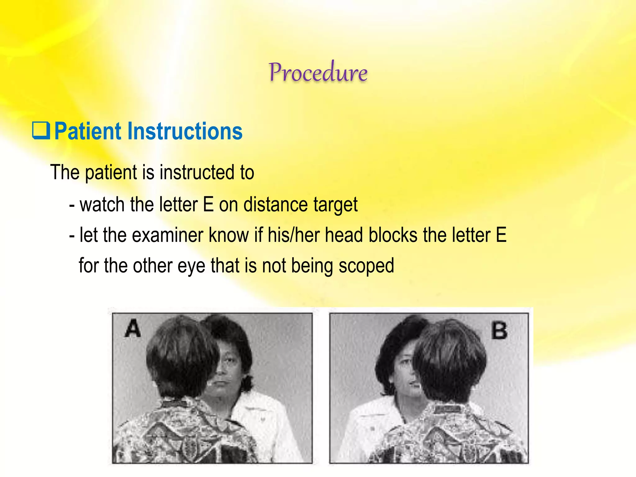 Retinoscopy/ Objective Refraction / Retinoscopy of eye (Principle ...