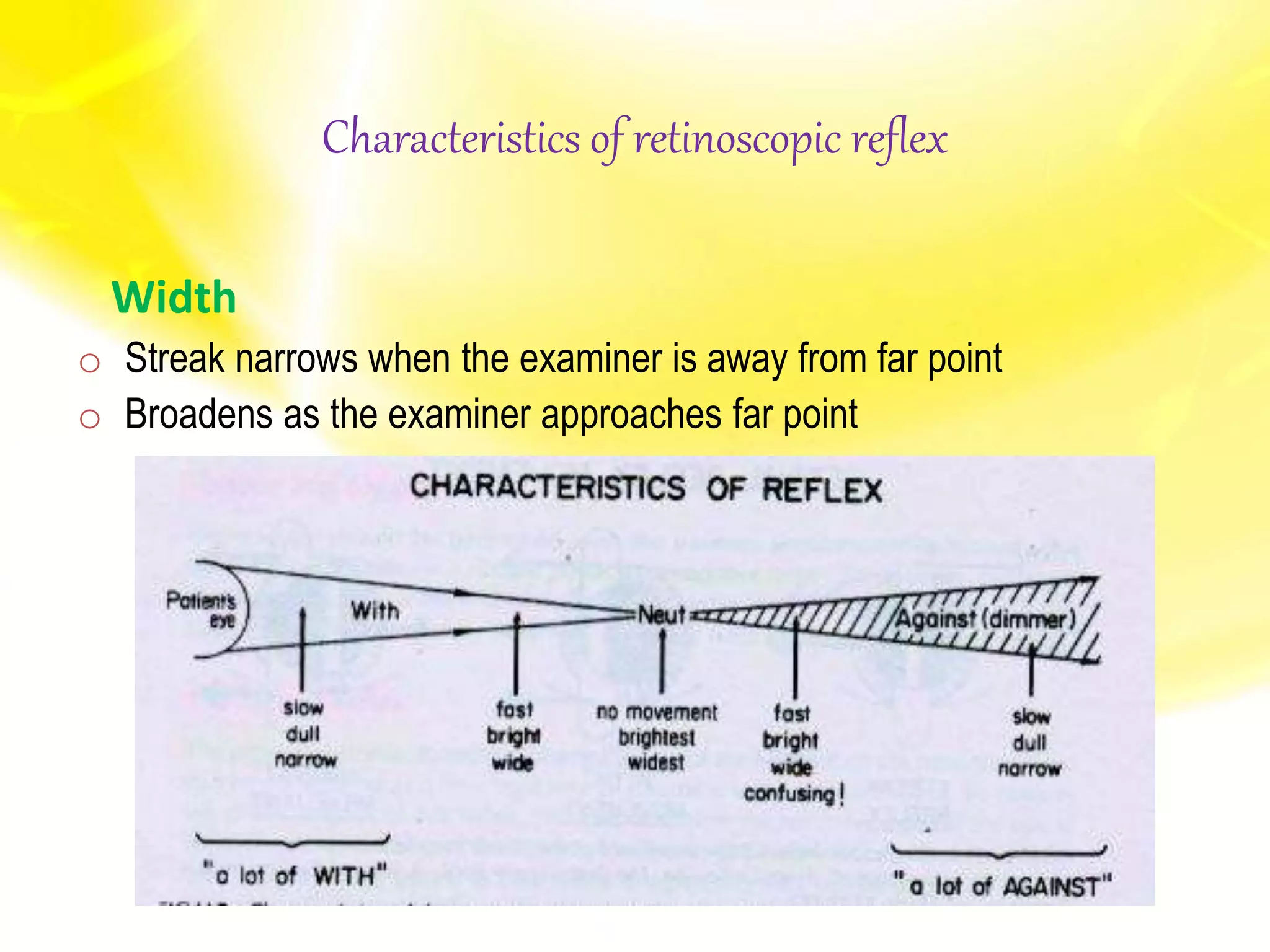 Retinoscopy/ Objective Refraction / Retinoscopy of eye (Principle ...