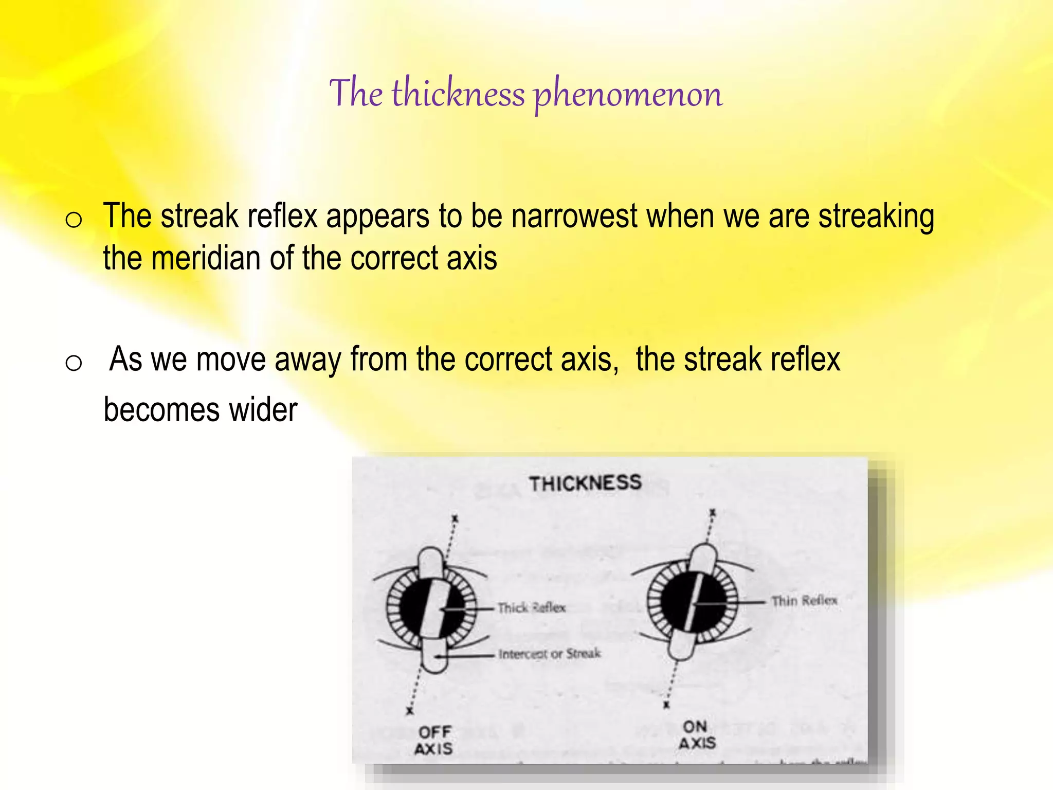 Retinoscopy/ Objective Refraction / Retinoscopy of eye (Principle ...