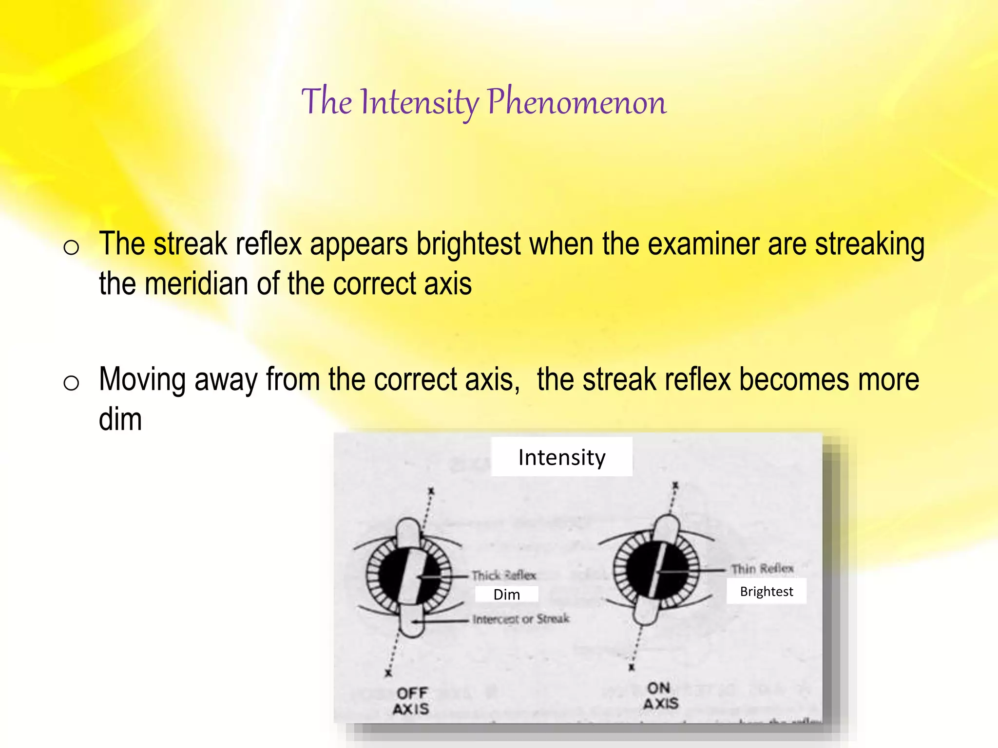 Retinoscopy/ Objective Refraction / Retinoscopy of eye (Principle ...