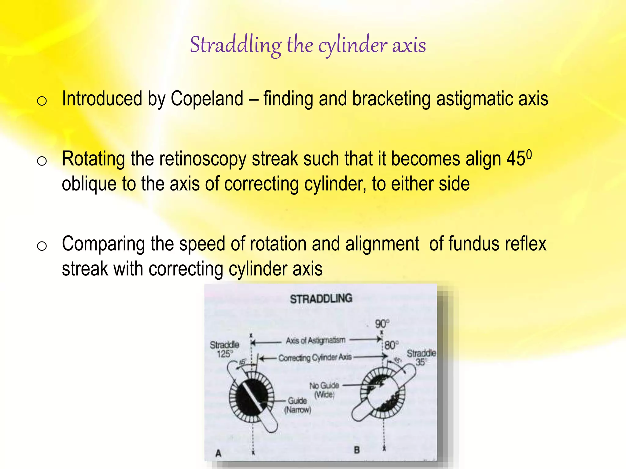 Retinoscopy/ Objective Refraction / Retinoscopy of eye (Principle ...