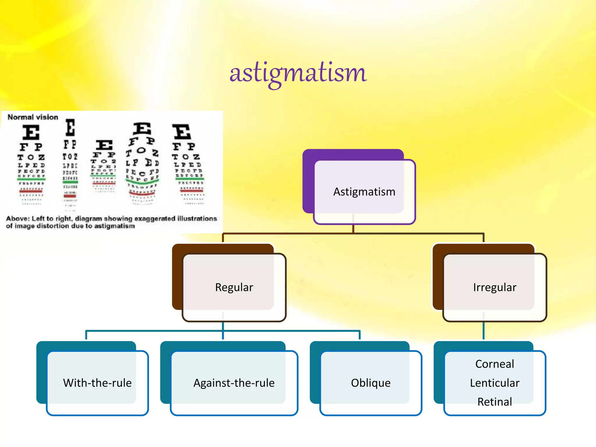 Retinoscopy/ Objective Refraction / Retinoscopy of eye (Principle ...