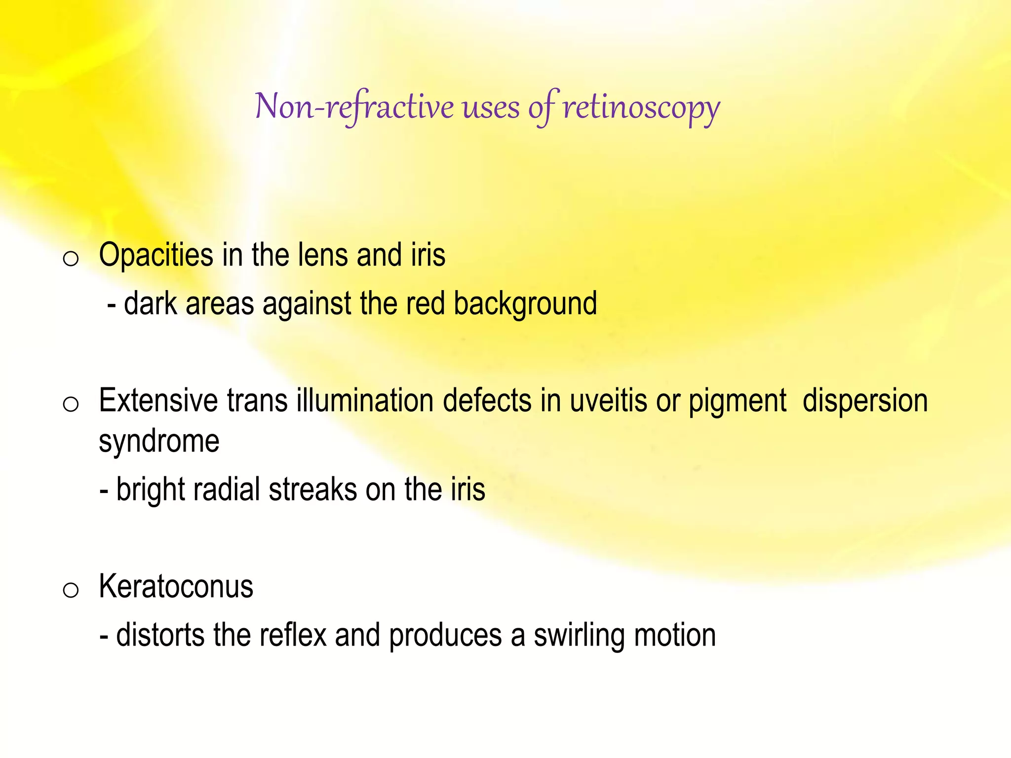 Retinoscopy/ Objective Refraction / Retinoscopy of eye (Principle ...