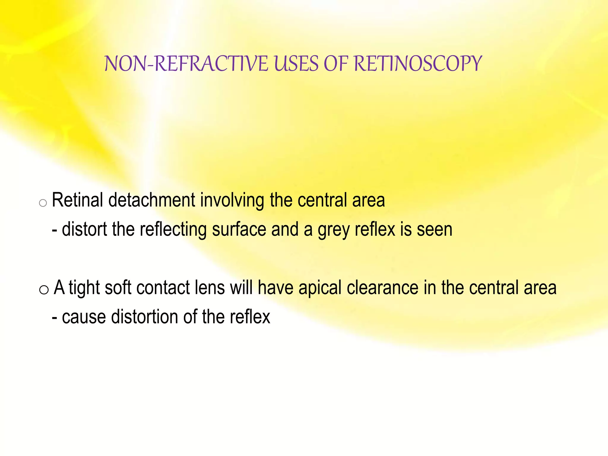Retinoscopy/ Objective Refraction / Retinoscopy of eye (Principle ...