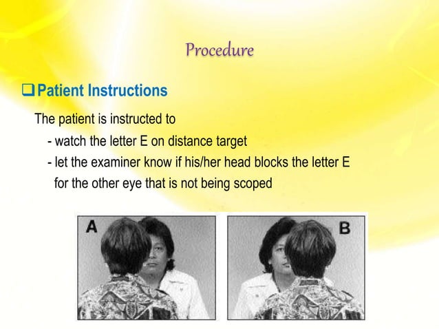 Retinoscopy/ Objective Refraction / Retinoscopy of eye (Principle ...