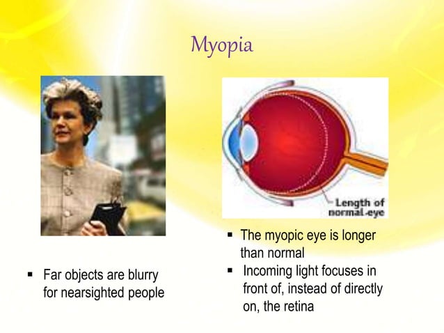 Retinoscopy/ Objective Refraction / Retinoscopy of eye (Principle ...