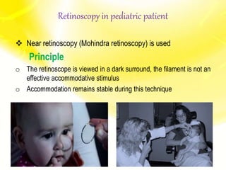 Retinoscopy/ Objective Refraction / Retinoscopy of eye (Principle ...