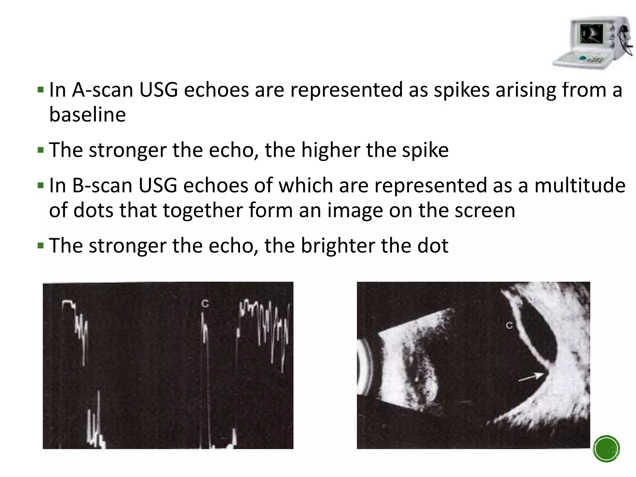 Ocular Ultrasonography/ Ophthalmic Ultrasonography (Ocular USG ...