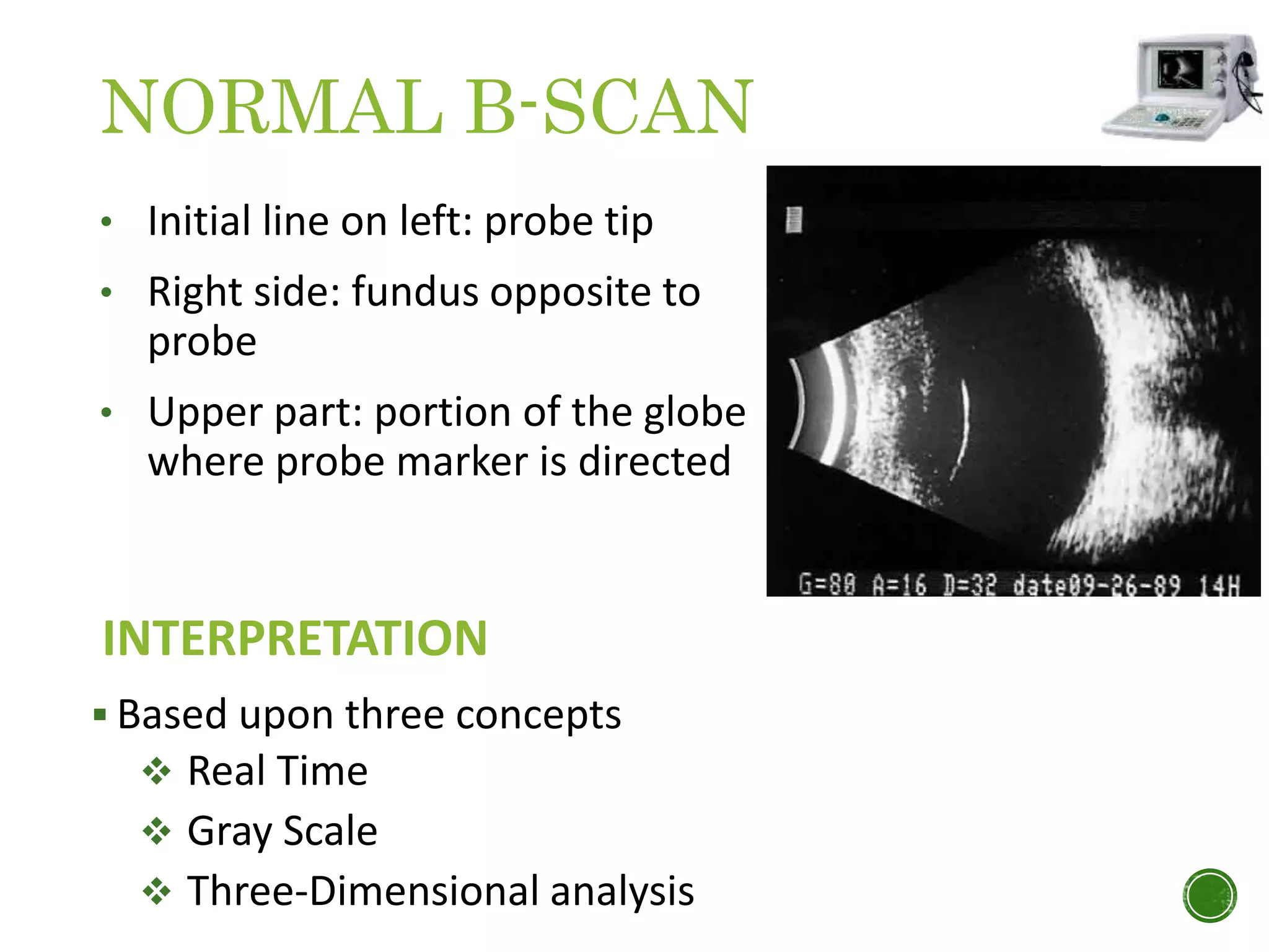 Ocular Ultrasonography/ Ophthalmic Ultrasonography (Ocular USG ...