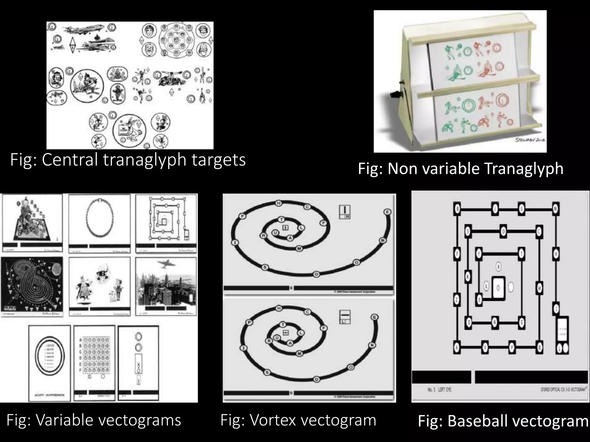 Vision Training/ Vision Therapy (Active/ Passive Vision Therapy ...