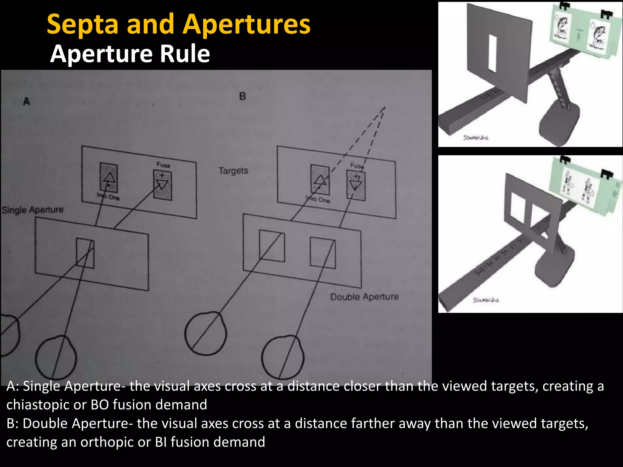 Vision Training/ Vision Therapy (Active/ Passive Vision Therapy ...