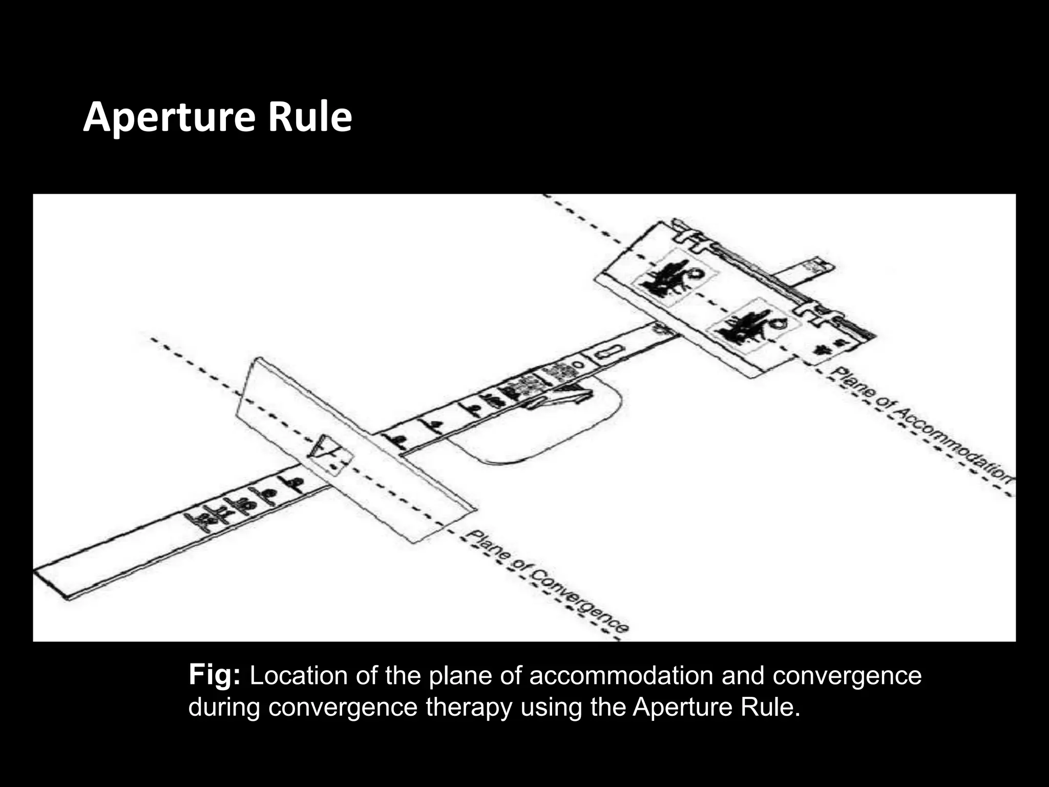 Vision Training/ Vision Therapy (Active/ Passive Vision Therapy ...