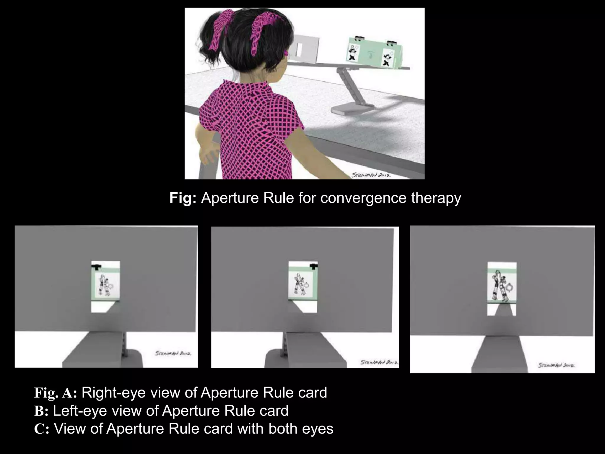 Vision Training/ Vision Therapy (Active/ Passive Vision Therapy ...