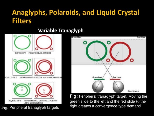 Vision Training/ Vision Therapy (Active/ Passive Vision Therapy)/ Spo…