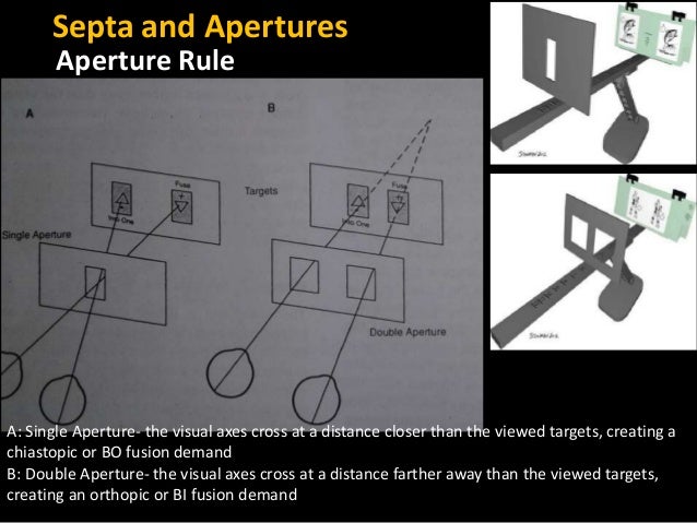 Vision Training/ Vision Therapy (Active/ Passive Vision Therapy)/ Spo…