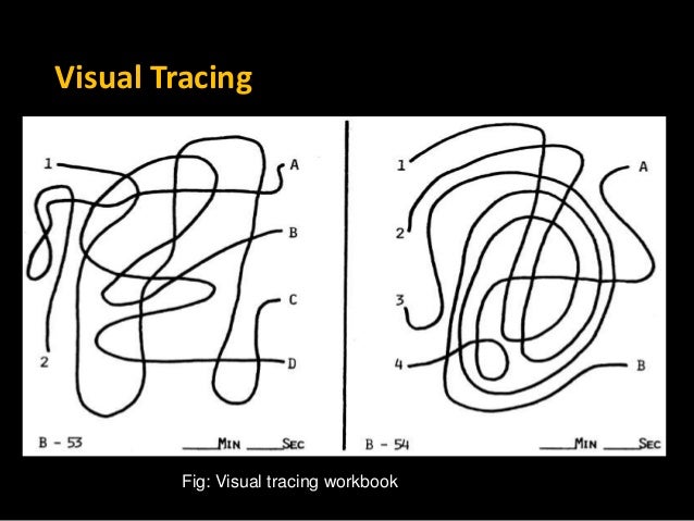 Vision Training/ Vision Therapy (Active/ Passive Vision Therapy)/ Spo…