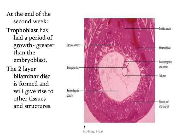 Bilaminar germ disc presentation | PPTX