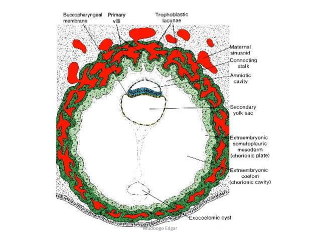 Bilaminar germ disc presentation | PPT