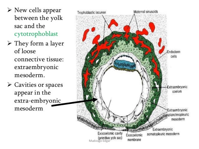Bilaminar germ disc presentation