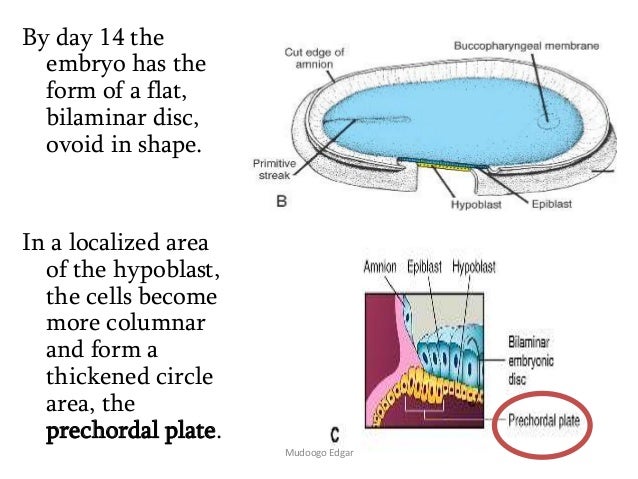 Bilaminar germ disc presentation