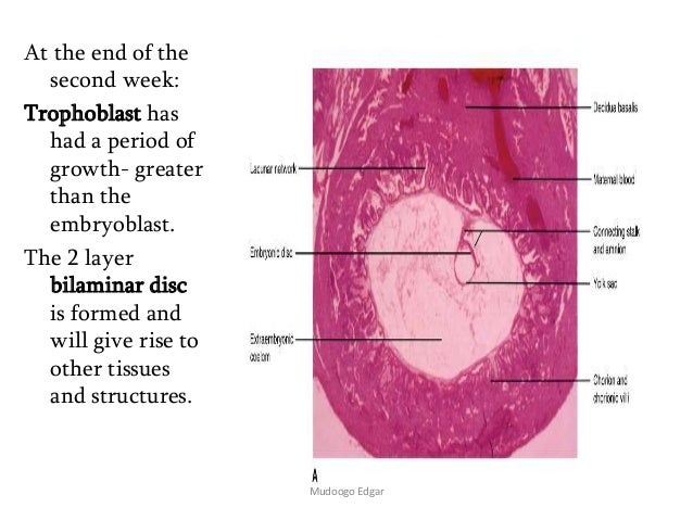 Bilaminar Disc