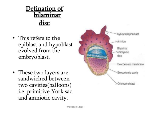 Bilaminar germ disc presentation