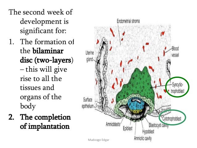 Bilaminar germ disc presentation