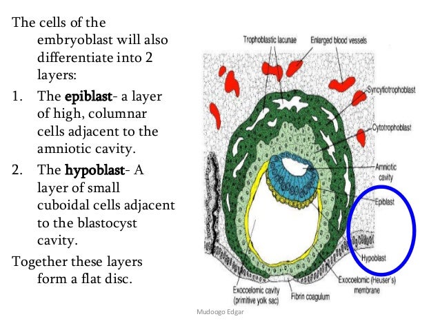 Bilaminar germ disc presentation