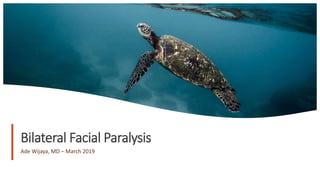 Bilateral Facial Paralysis | PPT