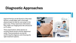 Bilateral Inguinal Hernia Repair - What You Need to Know.pdf