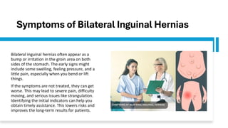 Bilateral Inguinal Hernia Repair - What You Need to Know.pdf