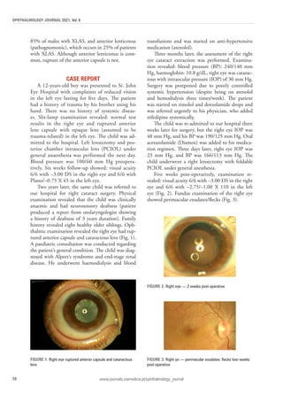 Bilateral lens capsule rupture in a patient with previously undiagnosed ...