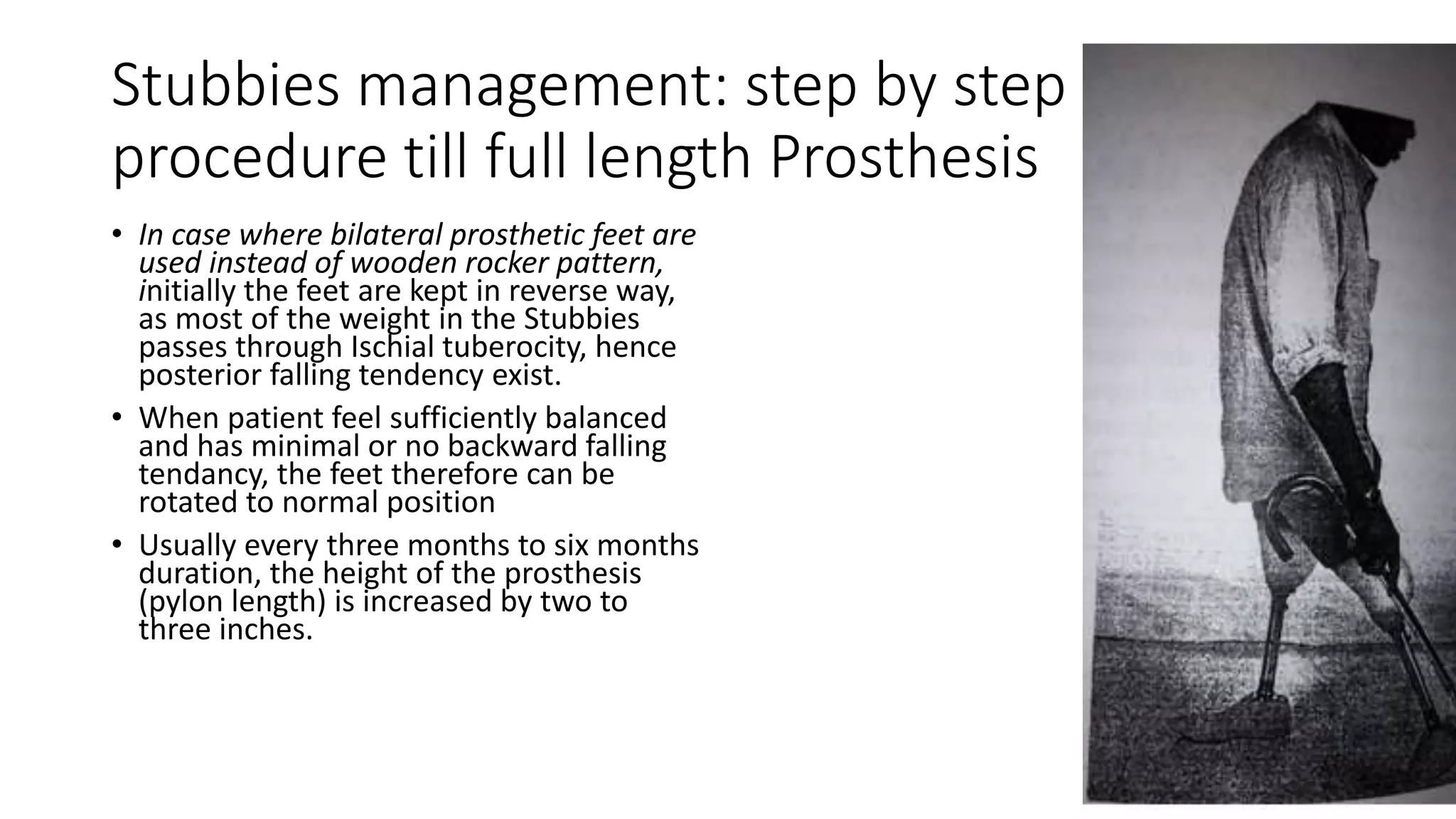 Bilateral Transfemoral amputation and stubbies (Prostheses).pptx
