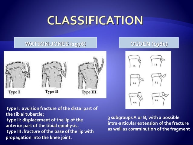 Avulsion simultanée bilatérale tubérosité tibiale antérieure