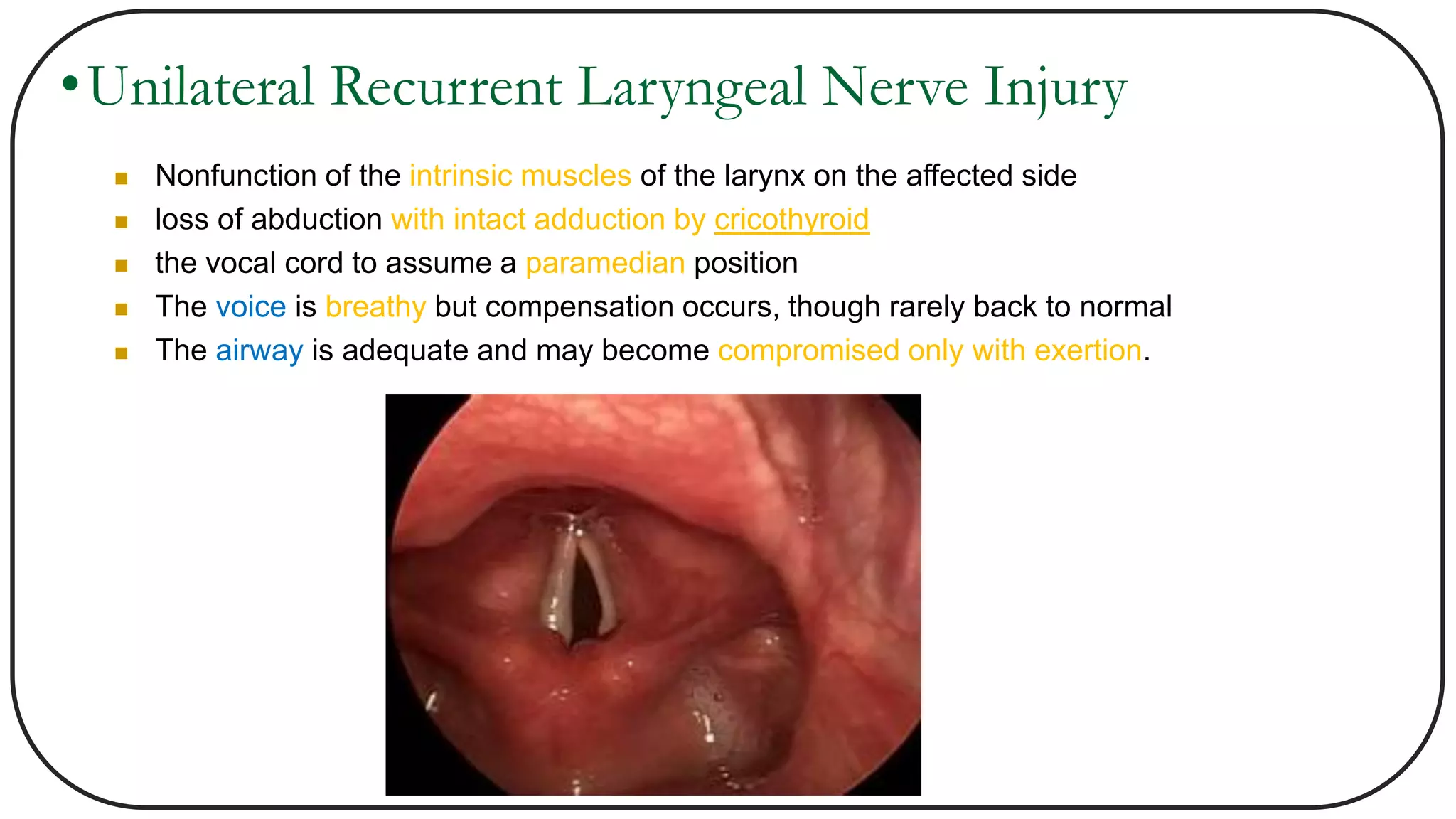 Bilateral TVC paralysis Dr. M. Erami | PDF