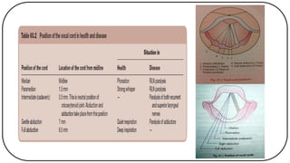 Bilateral TVC paralysis Dr. M. Erami | PDF