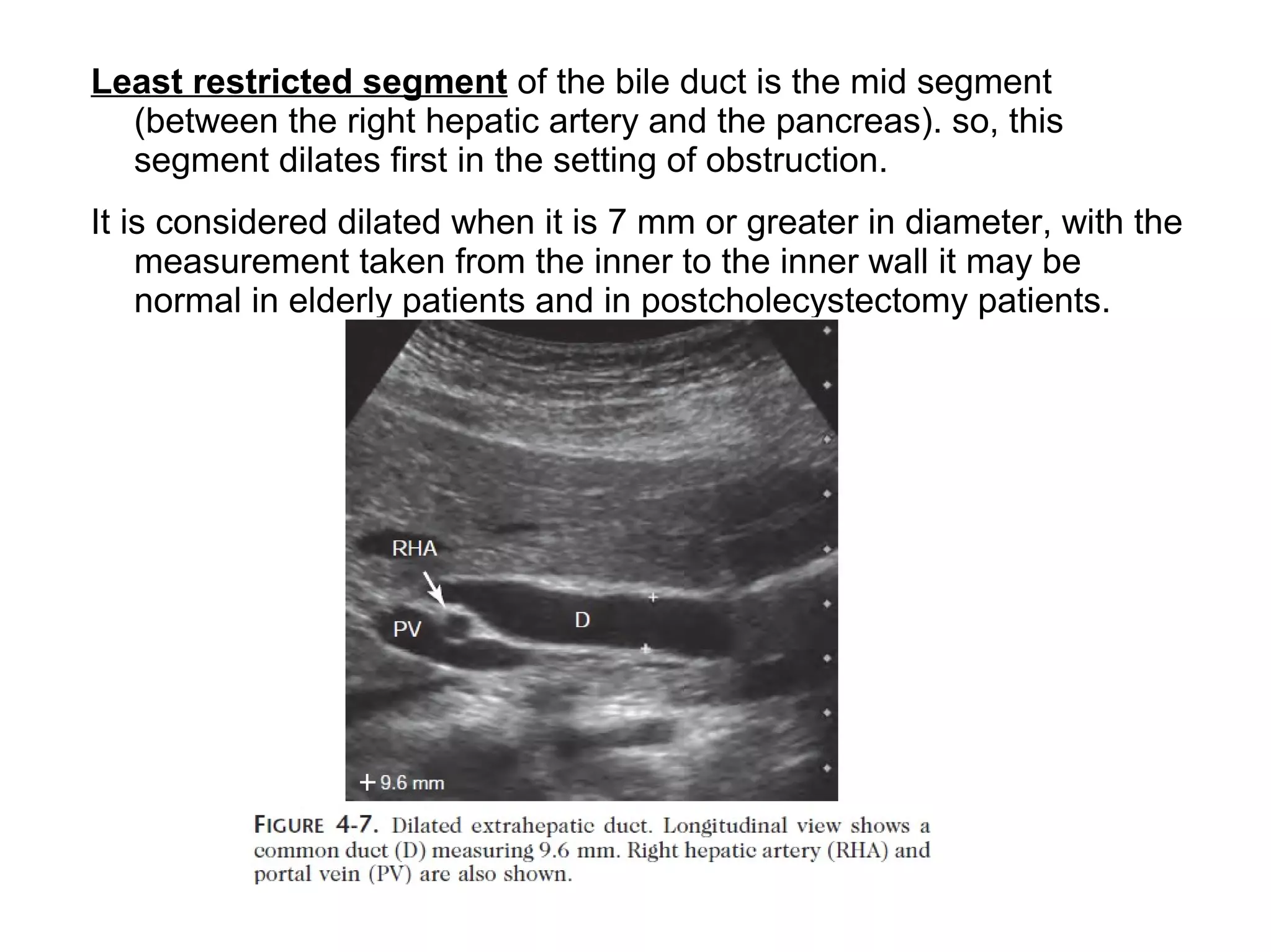 Bile duct Ultrasound | PPT