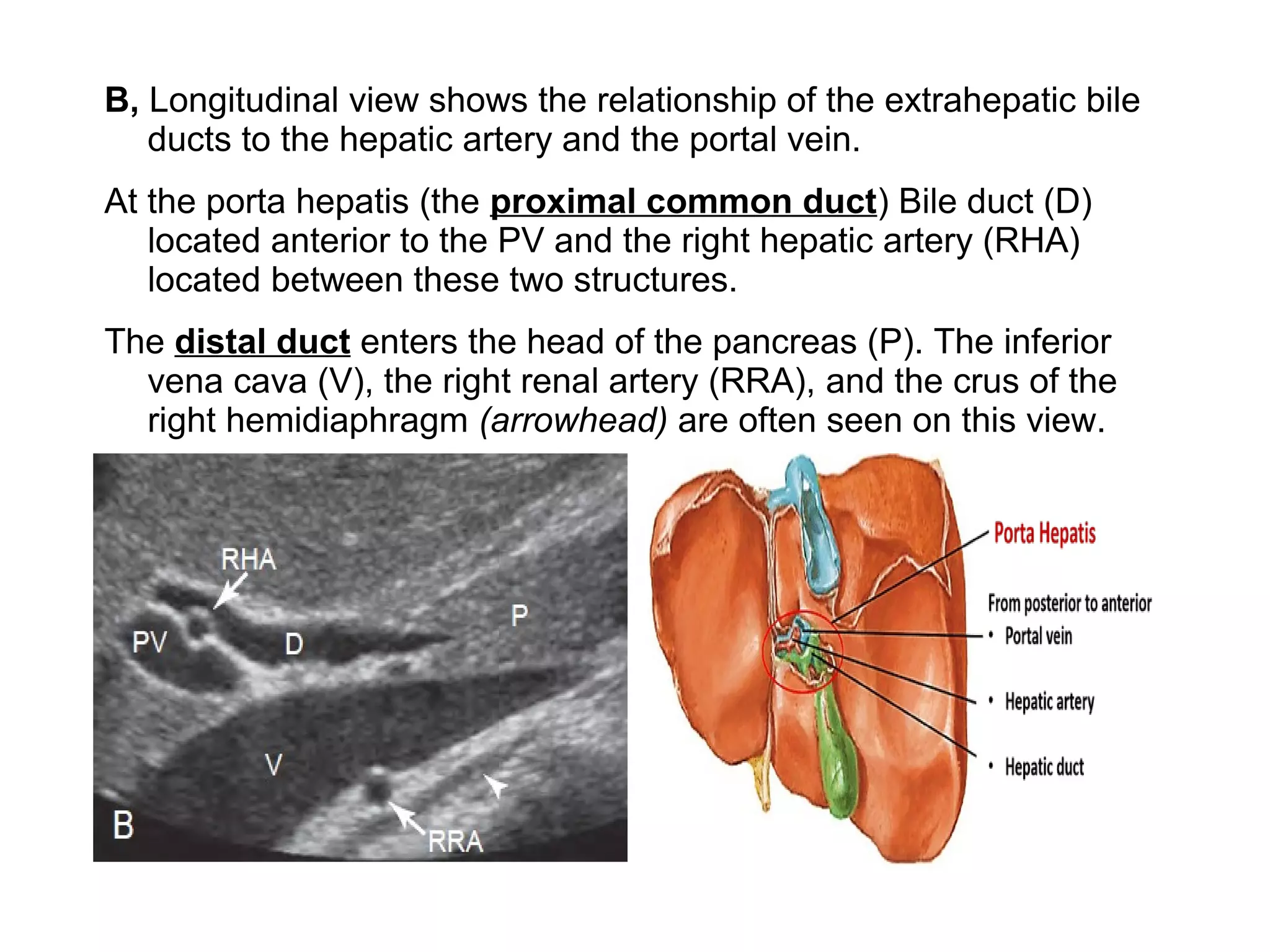Bile duct Ultrasound | PPT