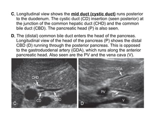 Bile duct Ultrasound | PPT