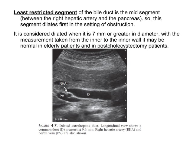 Bile Duct Ultrasound Ppt