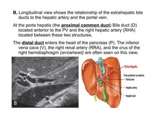 Bile duct Ultrasound | PPT