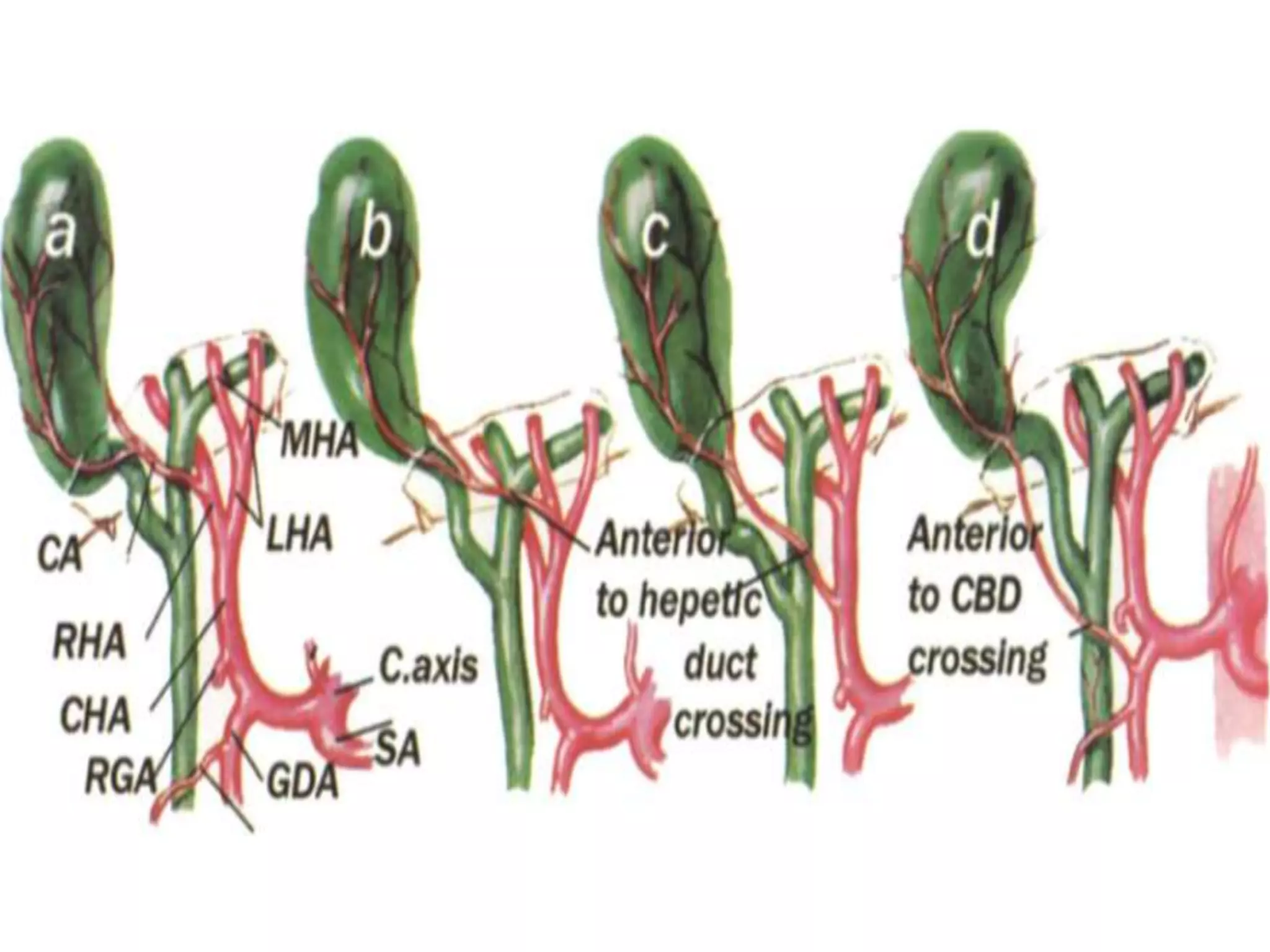 Bile duct injuries | PPSX