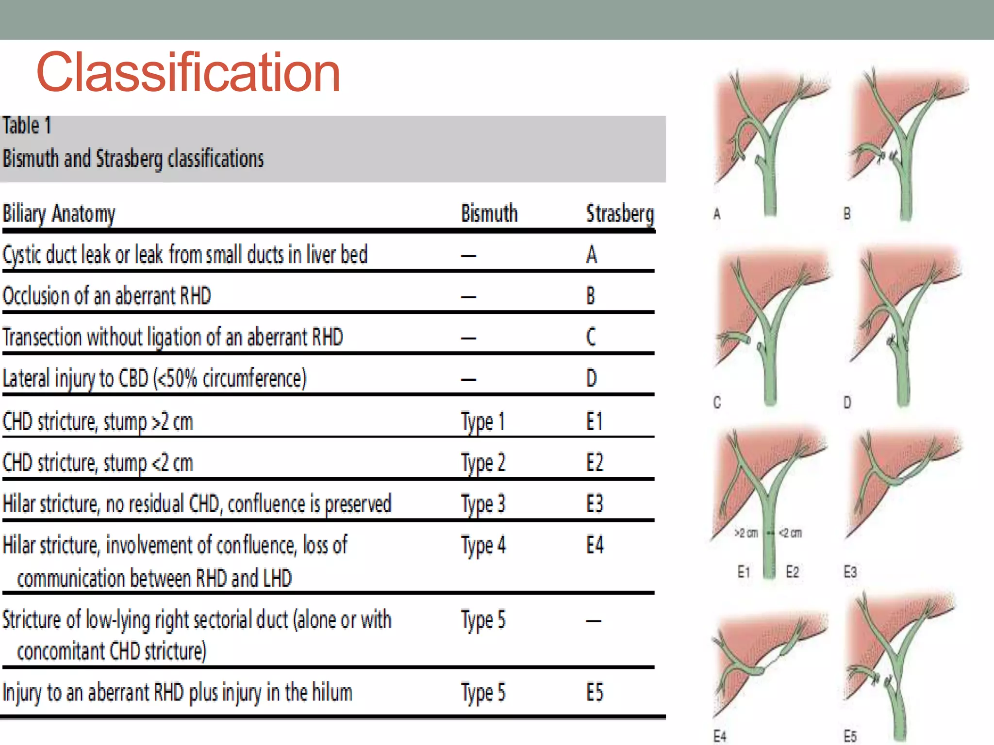 Bile duct injuries BDI | PPTX